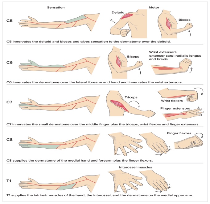 Cervical Radiculopathy